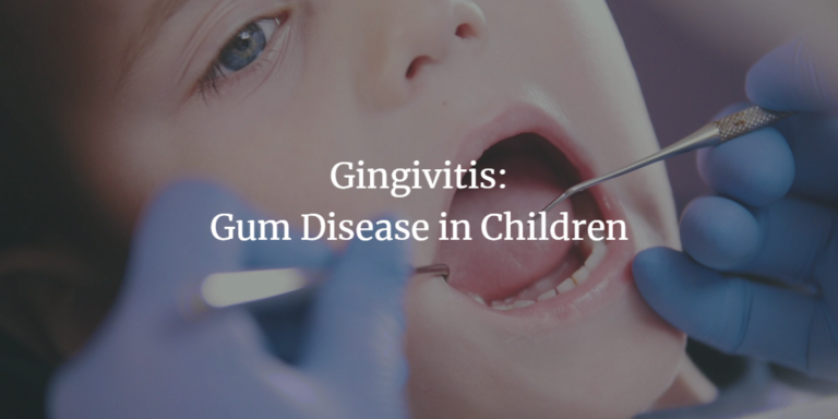Gingivitis: Gum Disease in Children (Periodontal Disease) - The Kidds Place